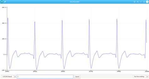 Ecg Filter Arduino Code Details Hackaday Io