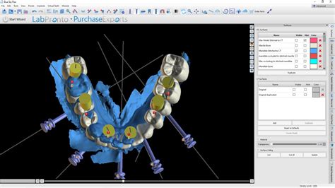 Dual Arch Guided Case Fp1 Over Hybrid Cory Glenn