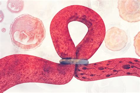 Isosmotic Definition And Examples Biology Online Dictionary