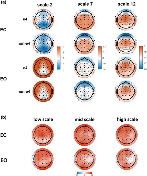 Resting‐state Brain Signal Complexity Discriminates Young Healthy Apoe