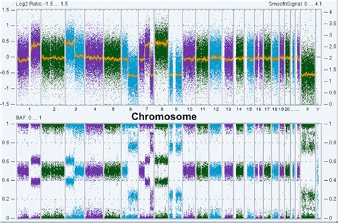 Copy Number Alterations Identified By Cytogenomic Microarray Upper