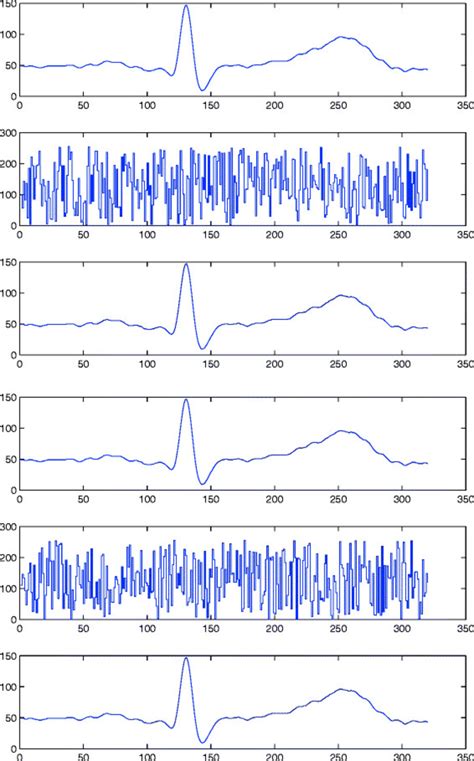 Dynamic Aes” For Ecg Signal Download Scientific Diagram