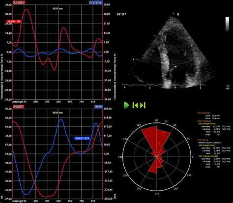 Representative Calculation Of Hemodynamic Force Parameters Obtained By