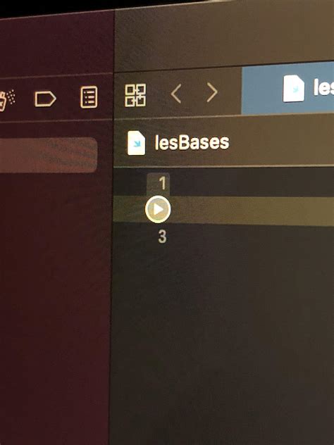 Does Anybody Know How To Remove This Button Its My First Time