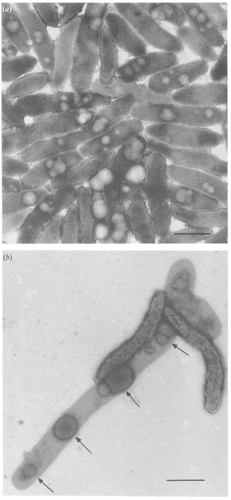 Table From Physiology And Morphology Of Legionella Pneumophila In Continuous Culture At Low