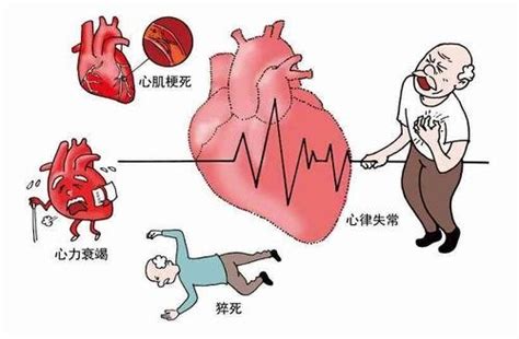 高血压与冠心病有关吗