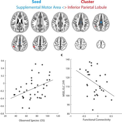 Functional Connectivity Between The Left Amygdala Seed Region Blue