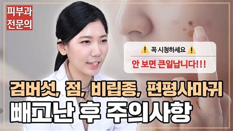 ⚠검버섯 점 비립종 편평사마귀 제거 전 후 필수 시청 영상 ⚠ㅣ노남경의 피부클래스 Youtube