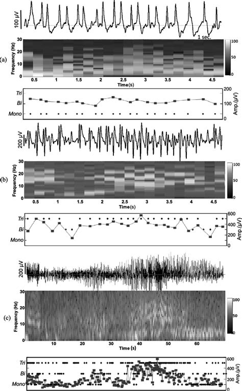 Detection Results Of The Proposed Method Displayed Are The A The Download Scientific Diagram