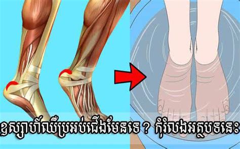 គួរអាន ឧស្សាហ៍ឈឺប្រអប់ជើងមែនទេ កុំរំលងអត្ថបទនេះ Tnaot