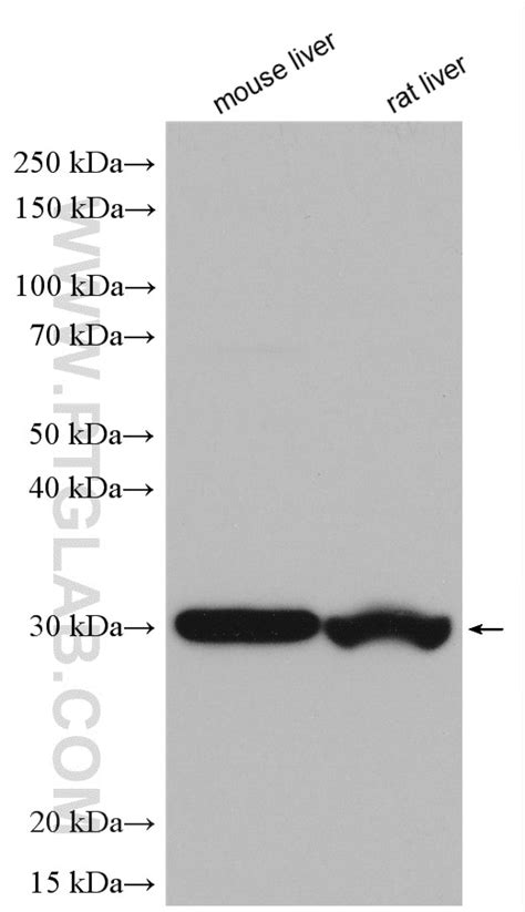 Hmgcl Antibody 16898 1 Ap Proteintech