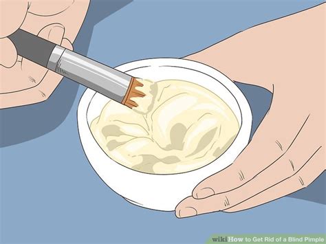 4 Ways To Get Rid Of A Blind Pimple WikiHow Life
