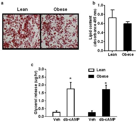 Adipogenic Differentiation Of Cultured Human Primary Subcutaneous White
