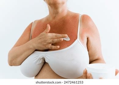 Hundred Naked Women Tan Lines Royalty Free Images Stock Photos Pictures Shutterstock