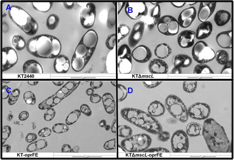 Pseudomonas Putida Gram Stain