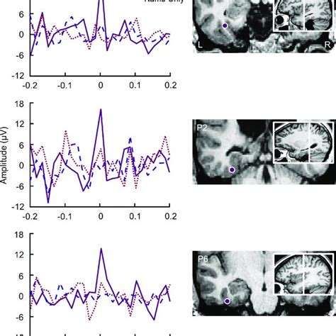 Quantification And Scalp Topography Of Eeg Responses In Experiment 1