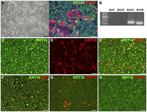 Characterization Of Mouse Ips Cell Derived Epithelial Clone 1204se1 Download Scientific