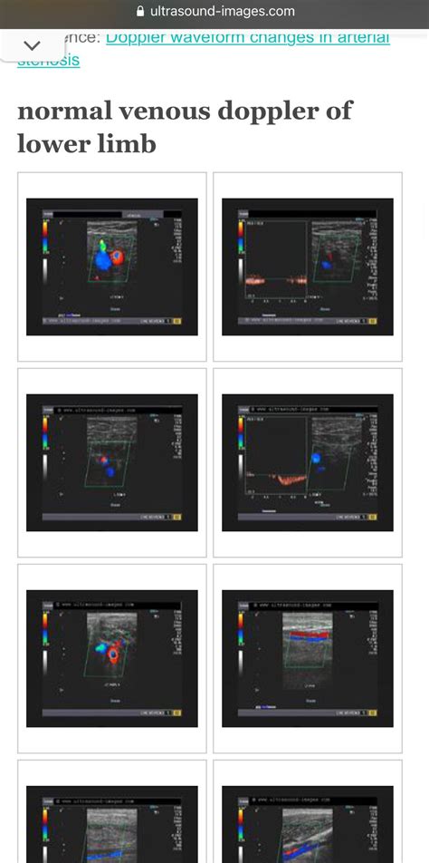 Hamad Saad Alhuthaili Posted On Linkedin