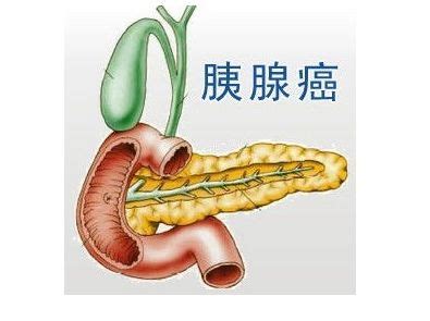 标签 G CSF 生物谷 第2页