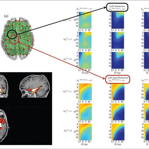 Components Of The Virtual Epileptic Patient Brain A Connectivity Download Scientific Diagram