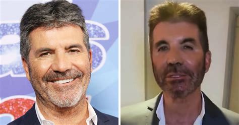 Fans Er Kritiske Over For Simon Cowells Uigenkendelige Ansigt I Den Nye Promo Til Britain´s Got