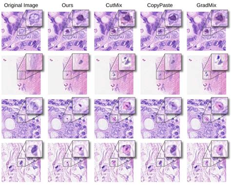 논문 리뷰 Nucleimix Realistic Data Augmentation For Nuclei Instance Segmentation