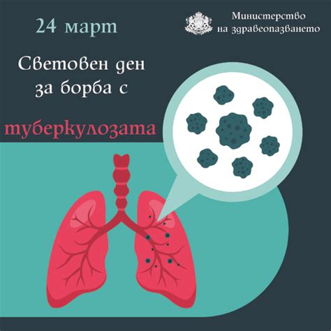 Кампания „Седмица на отворените врати” за безплатни прегледи по туберкулоза • МЗ