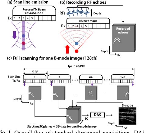 figure 1 from compressive dynamic aperture b mode ultrasound imaging