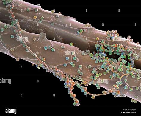 Fungal Spores Coloured Scanning Electron Micrograph Sem Of The Spores Of An Unidentified