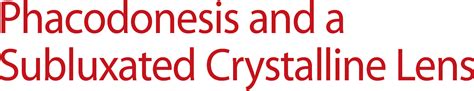 [pdf] Phacodonesis And A Subluxated Crystalline Lens Semantic Scholar