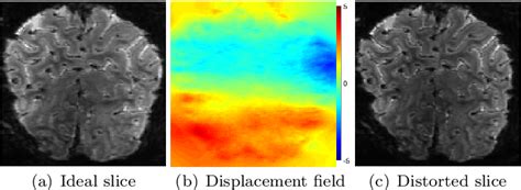 Table 1 From Susceptibility Artifact Correction For Sub Millimeter Fmri Using Inverse Phase