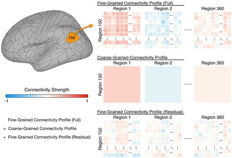 The Neural Basis Of Intelligence In Fine Grained Cortical Topographies