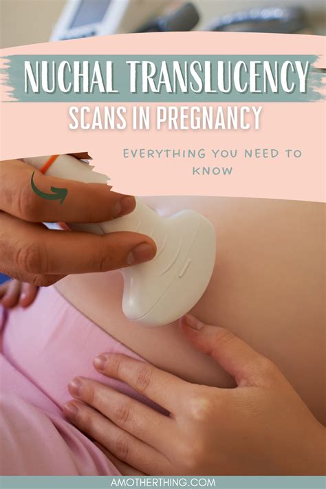 Everything You Need To Know About Nuchal Translucency Scans Its A Mother Thing