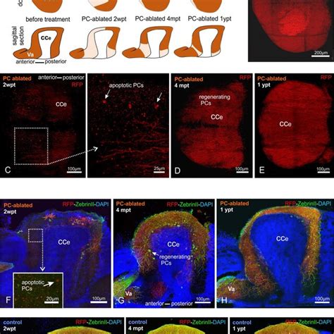 Somatic Responses Depending On The Dendritic Properties Of Diameter And
