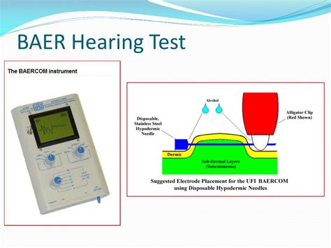 Ppt Baer Hearing Test Powerpoint Presentation Free Download Id2810616