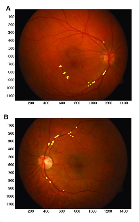 A An Example Of Applying The Algorithm Of Figure 7 To Image 005 In Download Scientific