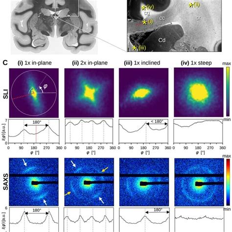 Diffusion MRI measurement of a 3 5x3 5x1cm³ human brain specimen 200μm Download Scientific