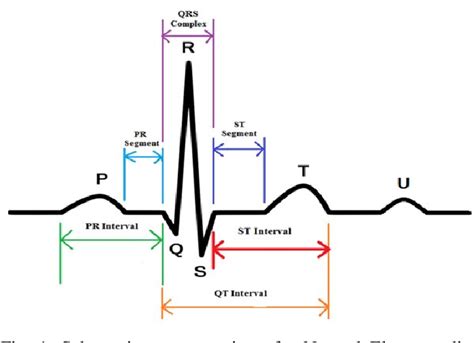 Figure 1 From Healthcare Decision Making With An Ecg Based Biometric System Semantic Scholar