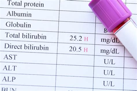 Normal Bilirubin Levels In Adults