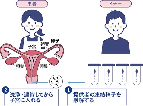 精子提供による人工授精（aid）とは？治療の流れや費用について解説 不妊治療は東京渋谷区のはらメディカルクリニック