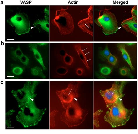 Effects Of No On F Actin And Focal Adhesions In Ptecs A Untreated