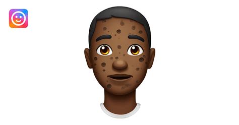 Hyperpigmentation Meme Emoji Ai Emoji Generator
