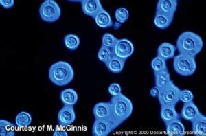 Cryptococcus Species Doctor Fungus