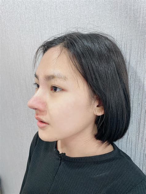 หมอวี คิวพฤศจิกายน เหลือ 7 วันสุดท้าย เหลาพรีเมี่ยม เนื้อเยื่อหลังหู เนื้อเยื่อเทียม ตะไบ