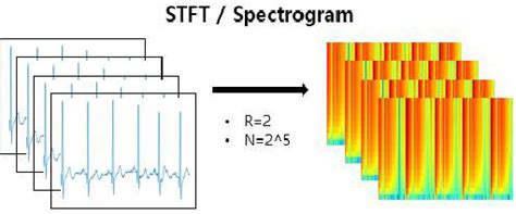 figure 4 from stress classification using ecgs based on a multi