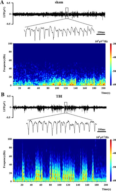 Characteristics Of Spike Wave Discharges Swd Events A B A Sample Download Scientific Diagram