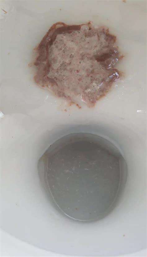 Better Stuff Birthday Puke 1