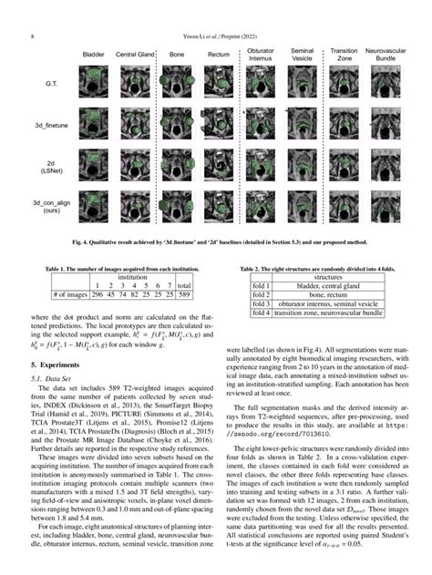Prototypical Few Shot Segmentation For Cross Institution Male Pelvic Structures With Spatial