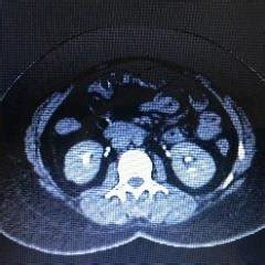 CT Scan With And Without Intravenous Contrast Download Scientific Diagram