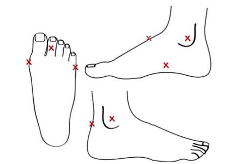 Evaluation Of Age Related Differences In Foot Anthropometry Among Women